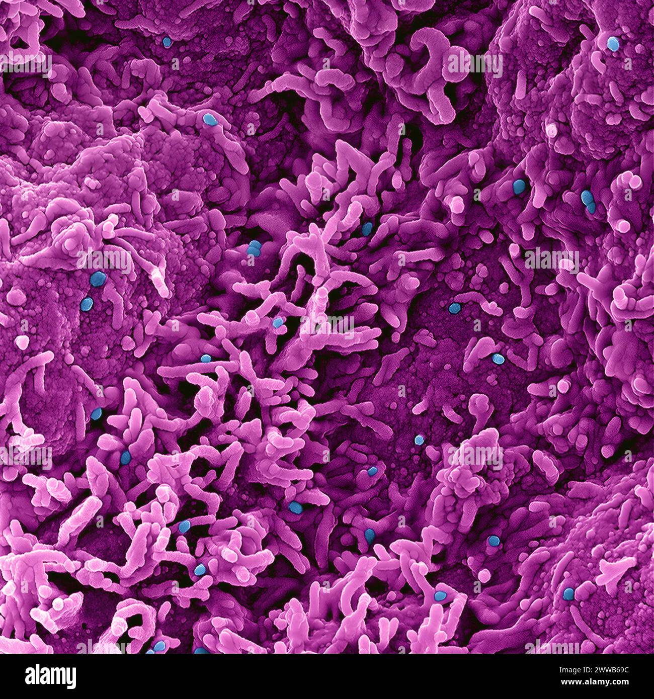 Colorized scanning electron micrograph of monkeypox virus (blue) on the ...