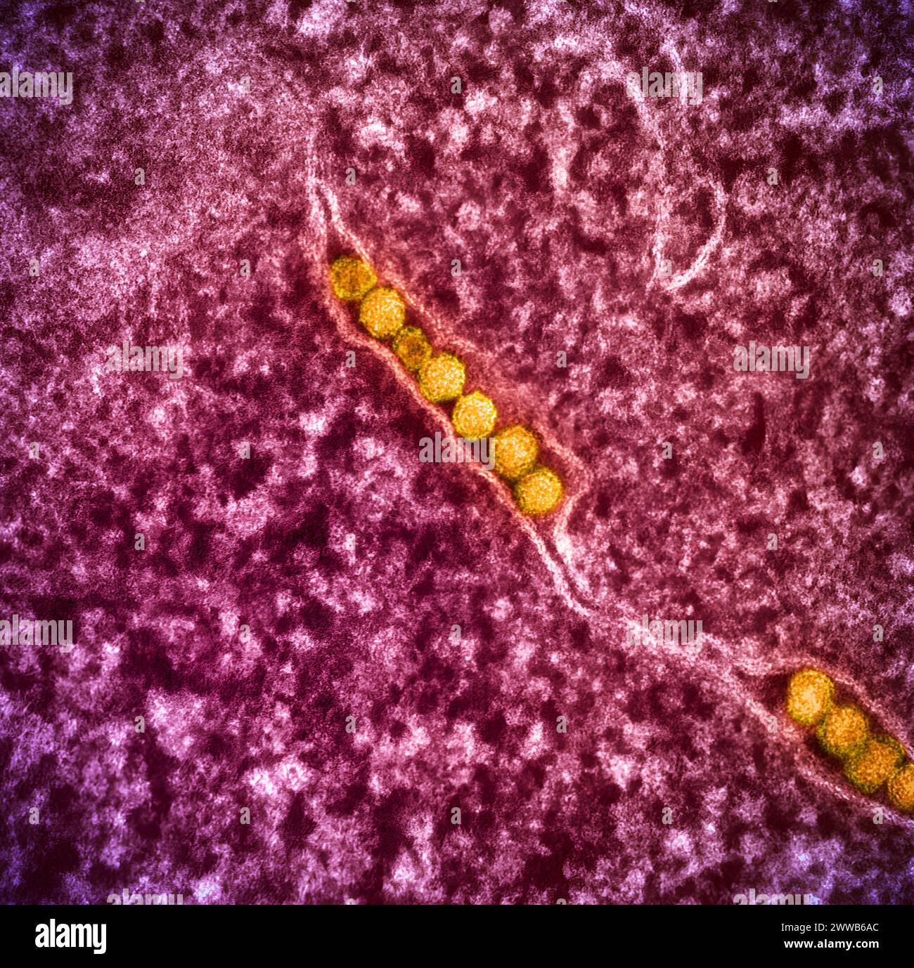 Transmission electron micrograph of West Nile virus particles (gold ...