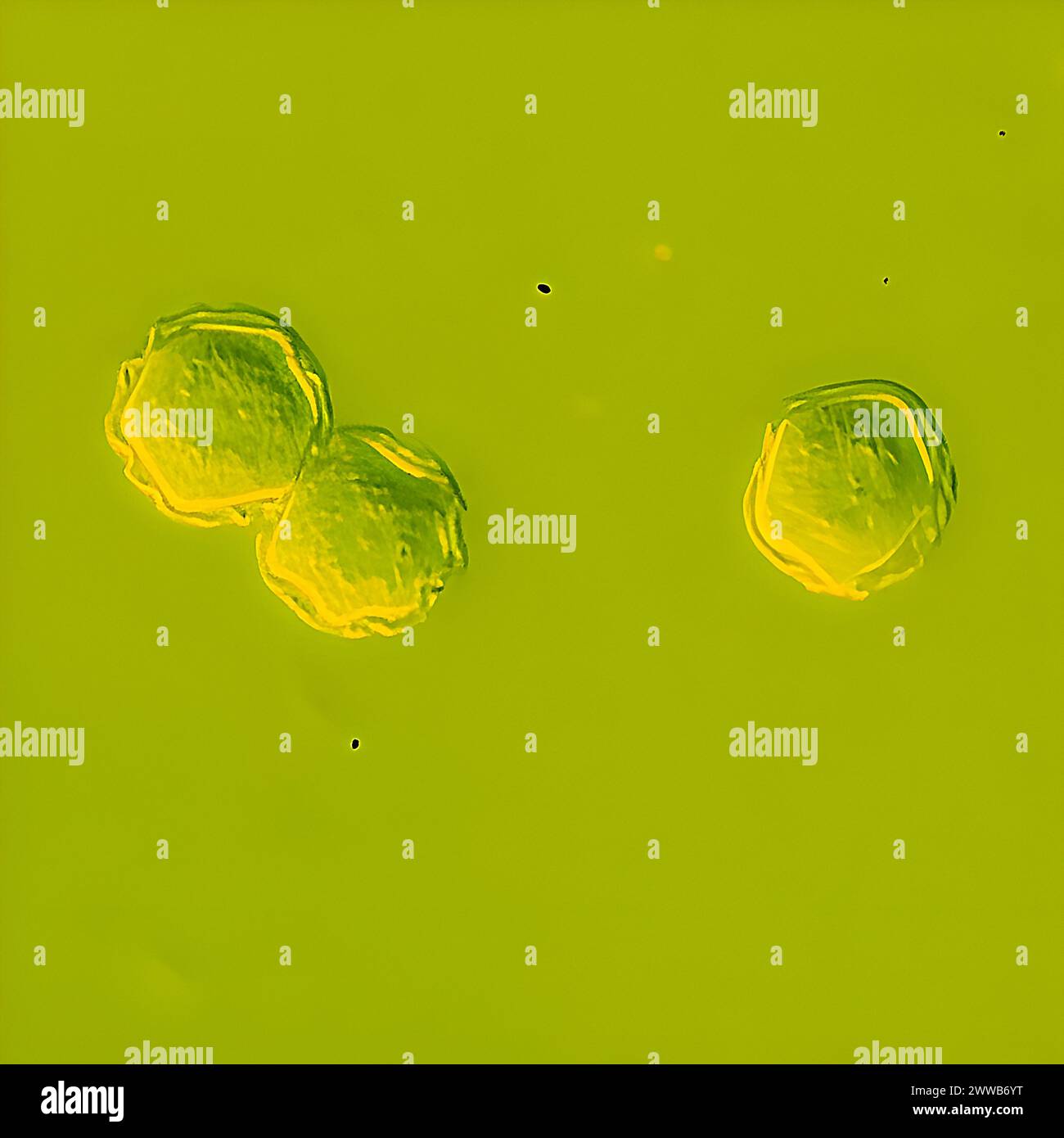 Acanthamoeba is a microscopic, free-living amoeba, or amoeba (single ...