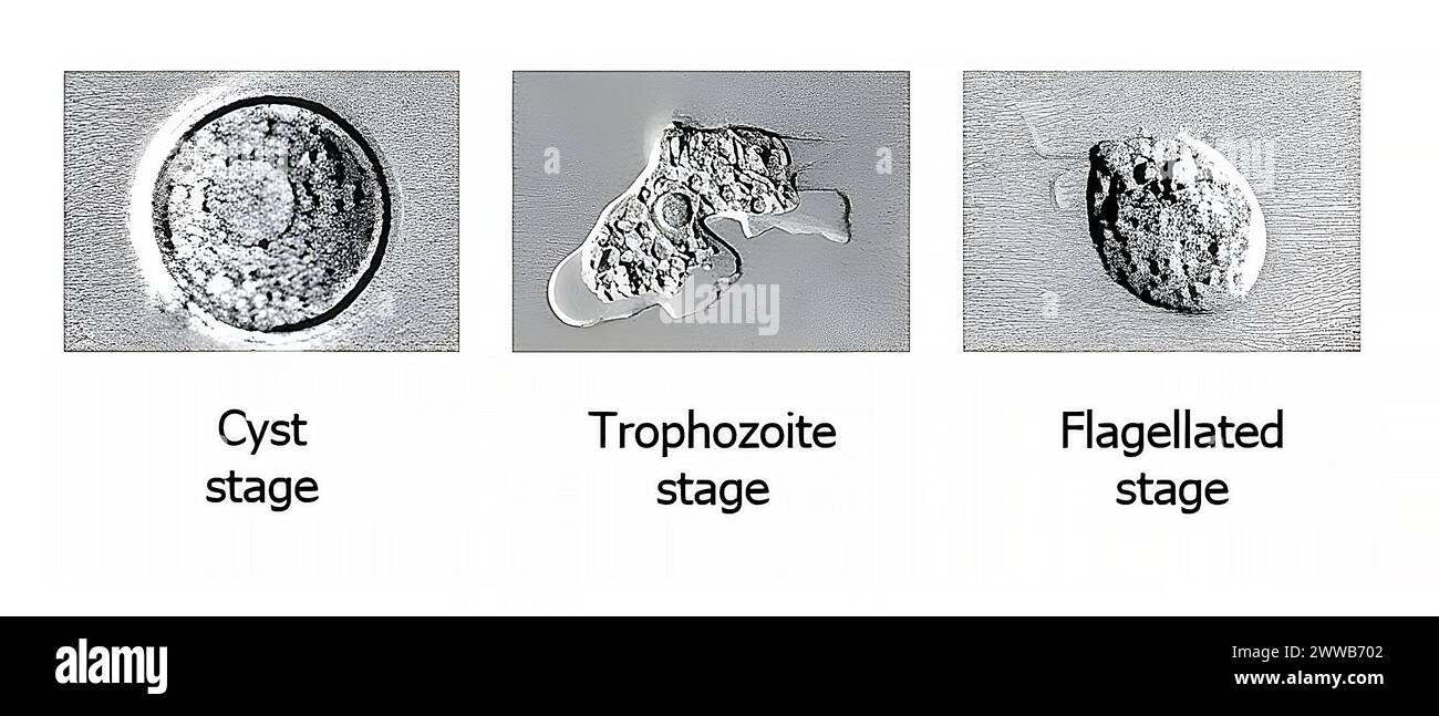 Naegleria Fowleri Cyst