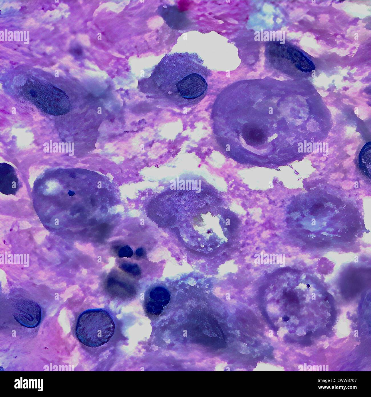 Human eye anatomy microscopic hi-res stock photography and images - Alamy