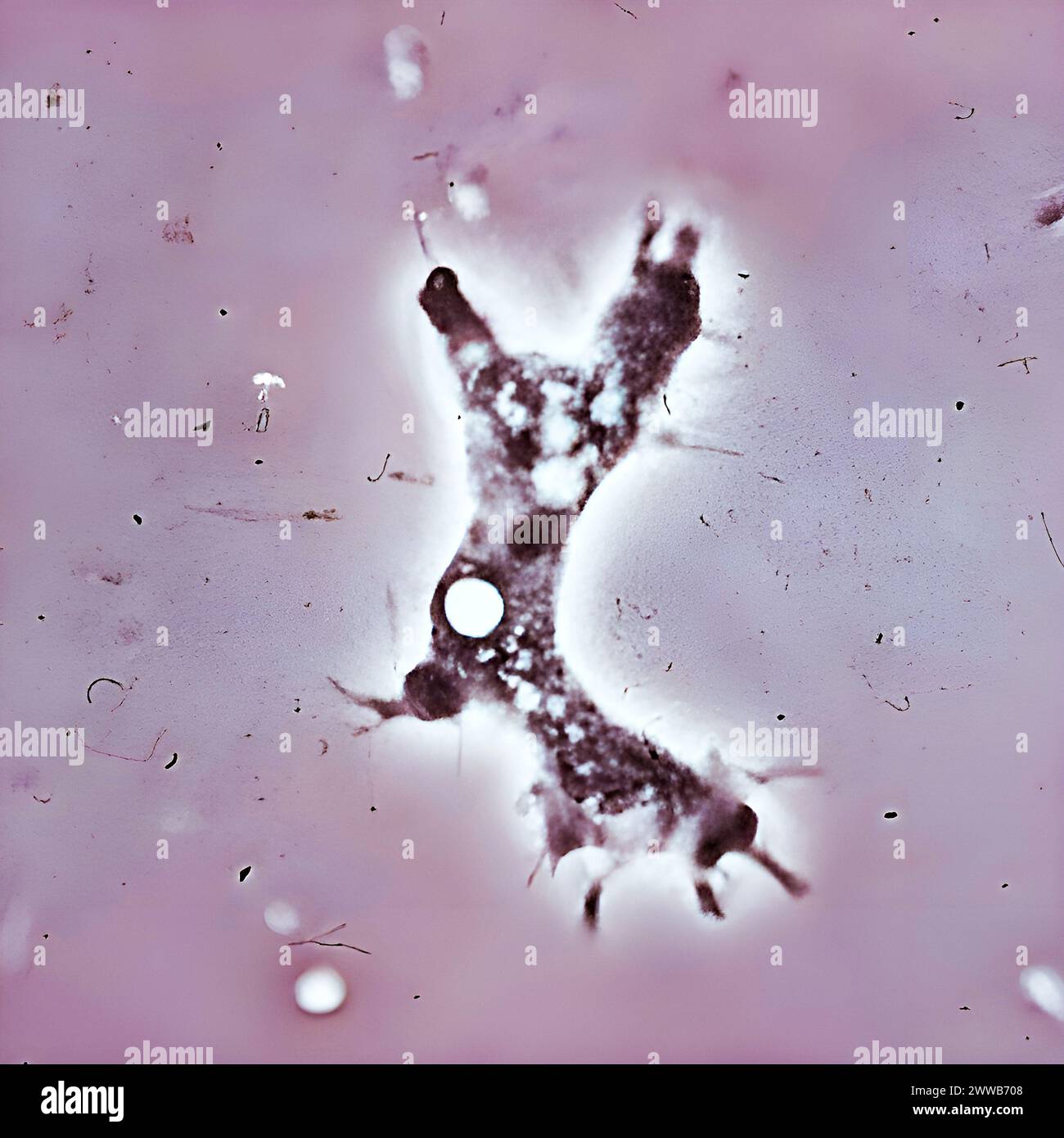 Acanthamoeba is a microscopic, free-living amoeba, or amoeba (single ...