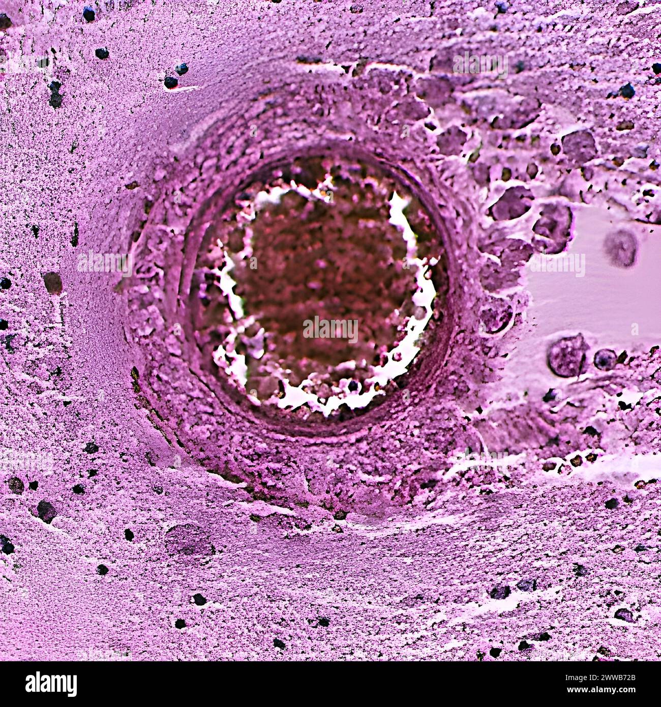 Balamuthia mandrillaris is a free-living amoeba (a single-celled living ...