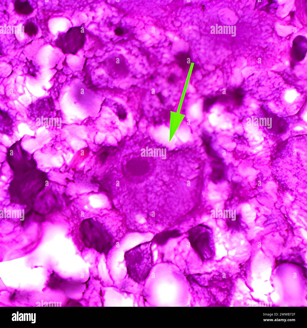 Balamuthia mandrillaris is a free-living amoeba (a single-celled living ...