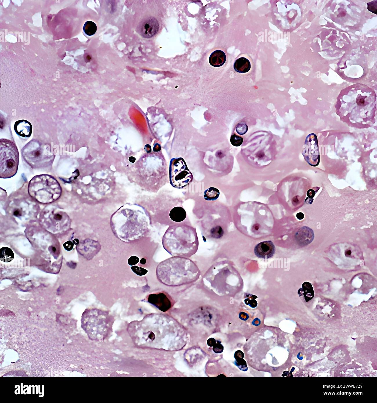 Balamuthia mandrillaris is a free-living amoeba (a single-celled living ...