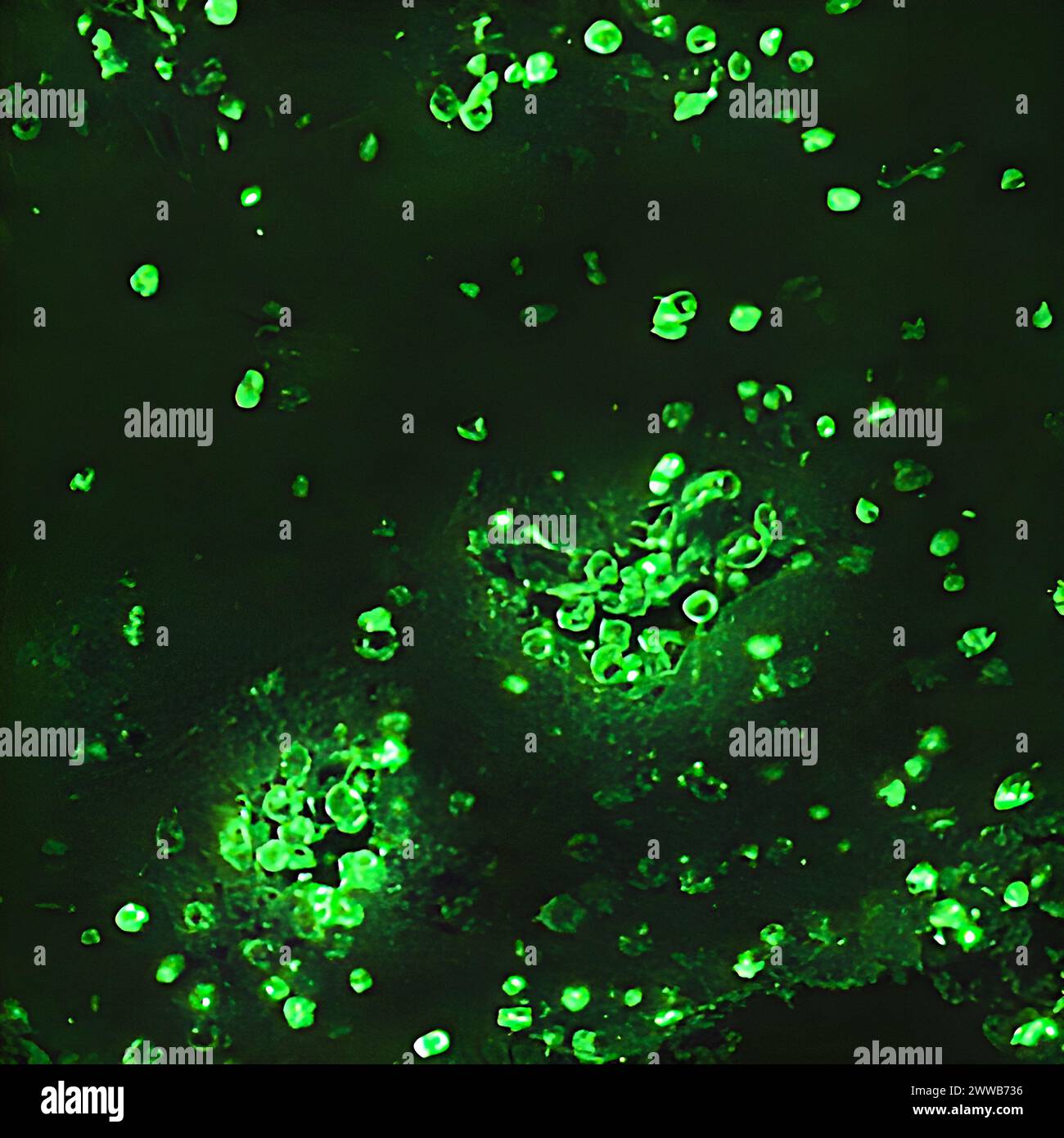Naegleria fowleri is an amoeba (one-celled living organism) that lives ...