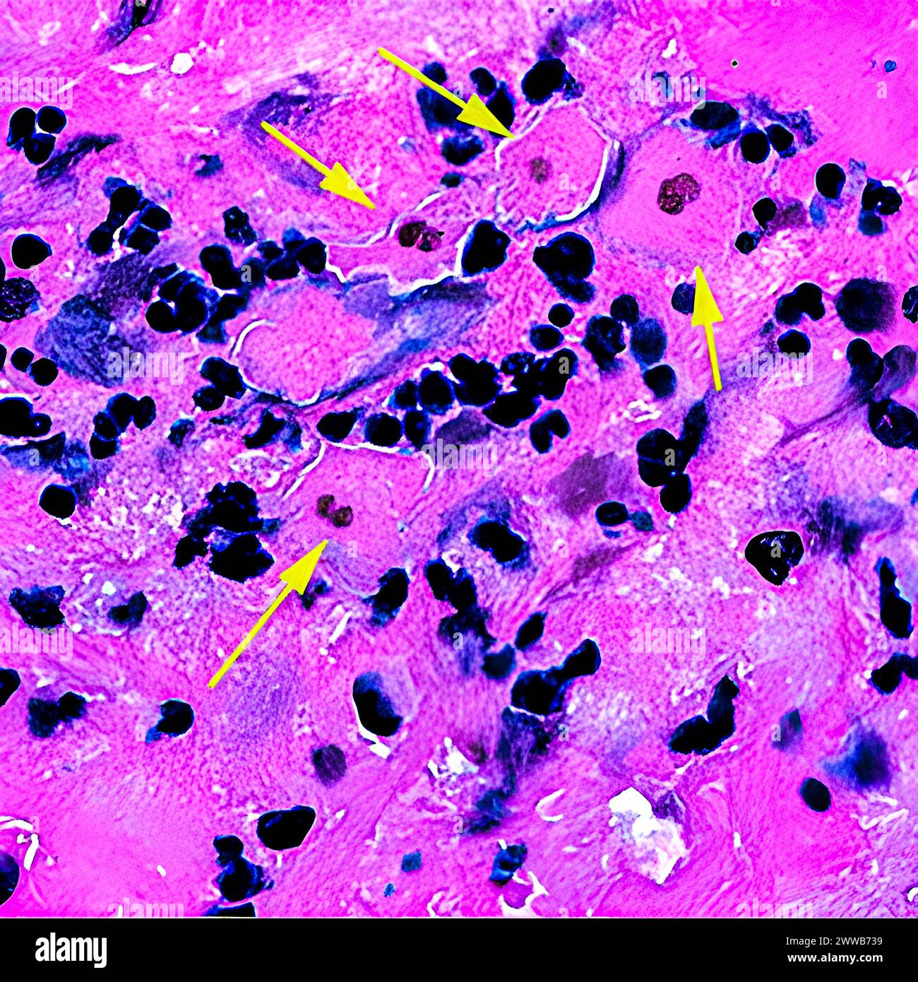 Amoeba hi-res stock photography and images - Alamy