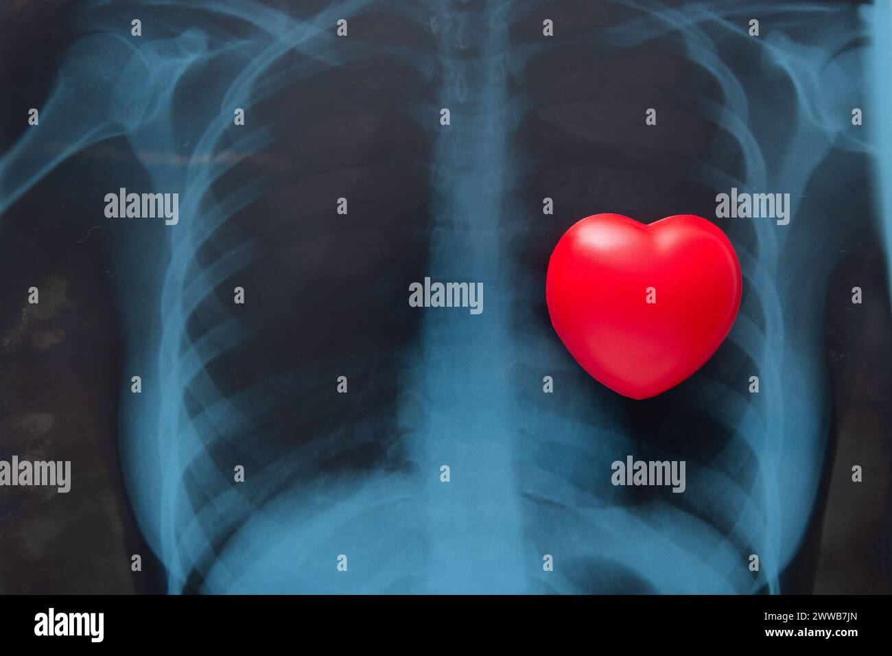 Chest x ray check hi-res stock photography and images - Alamy