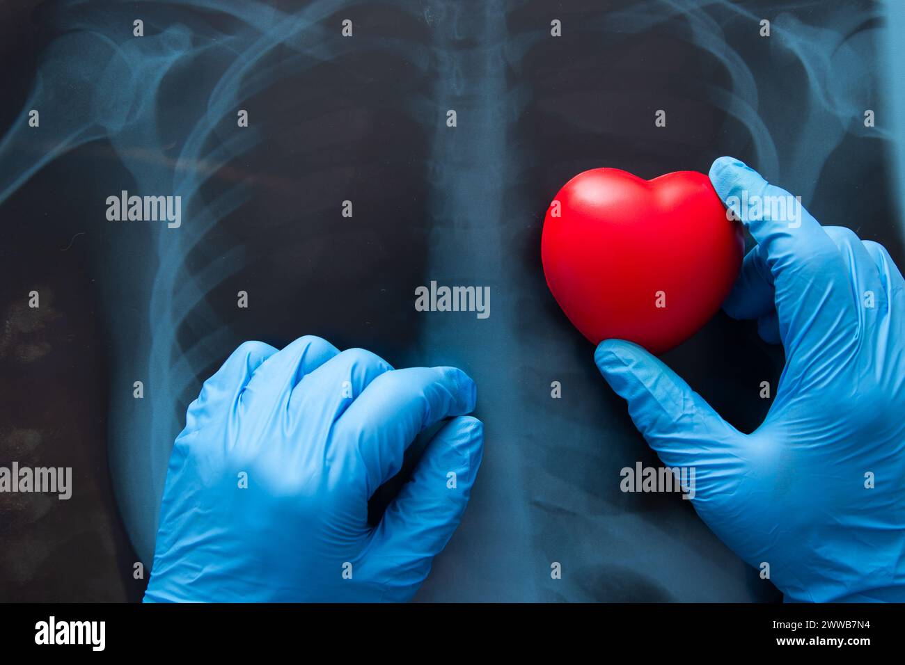 Chest x ray check hi-res stock photography and images - Alamy