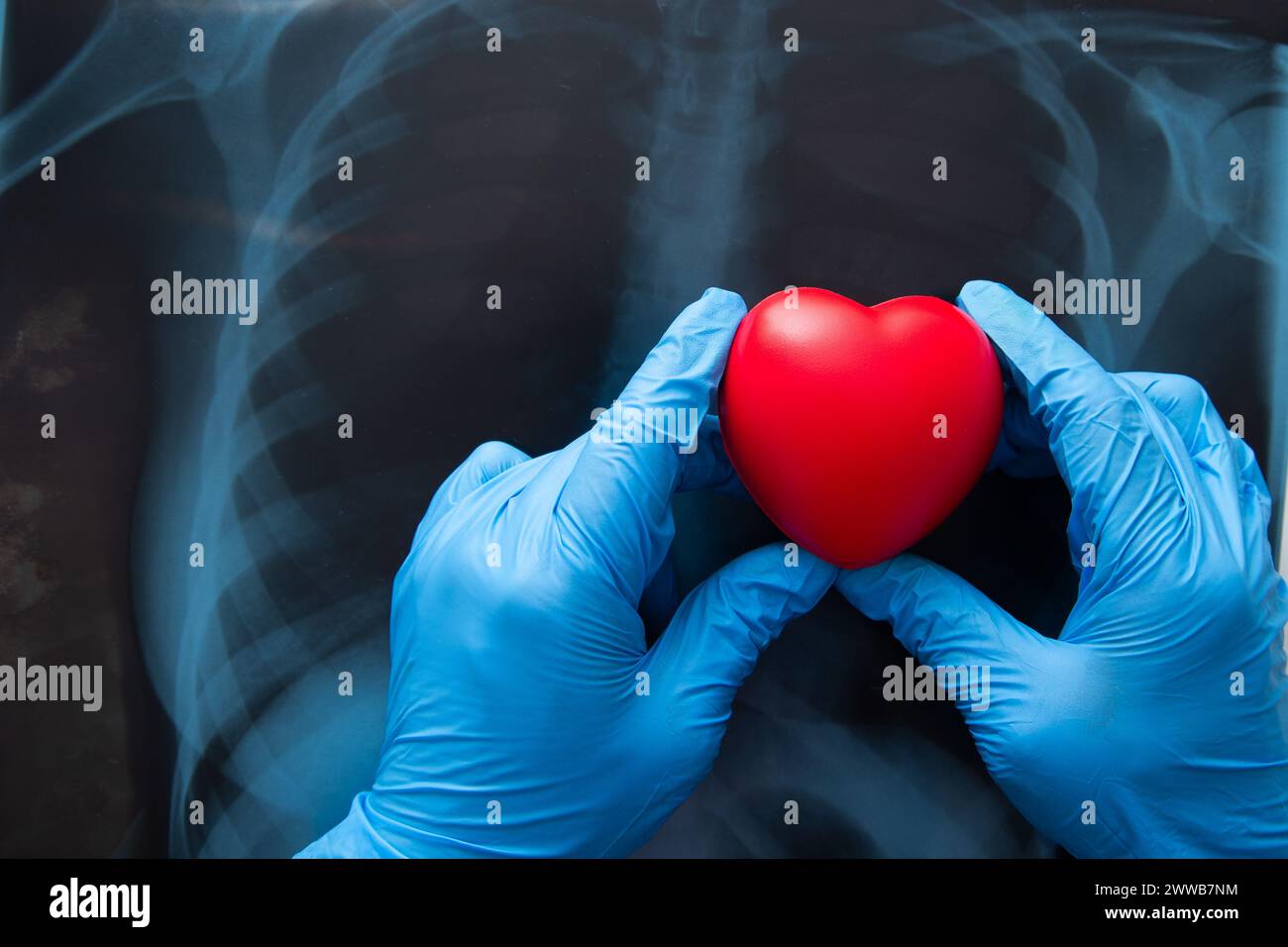 Red heart on x ray chest. Medical Concept Stock Photo - Alamy
