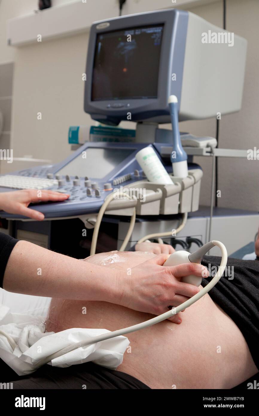 1 2 Weeks Pregnant Ultrasound Pictures