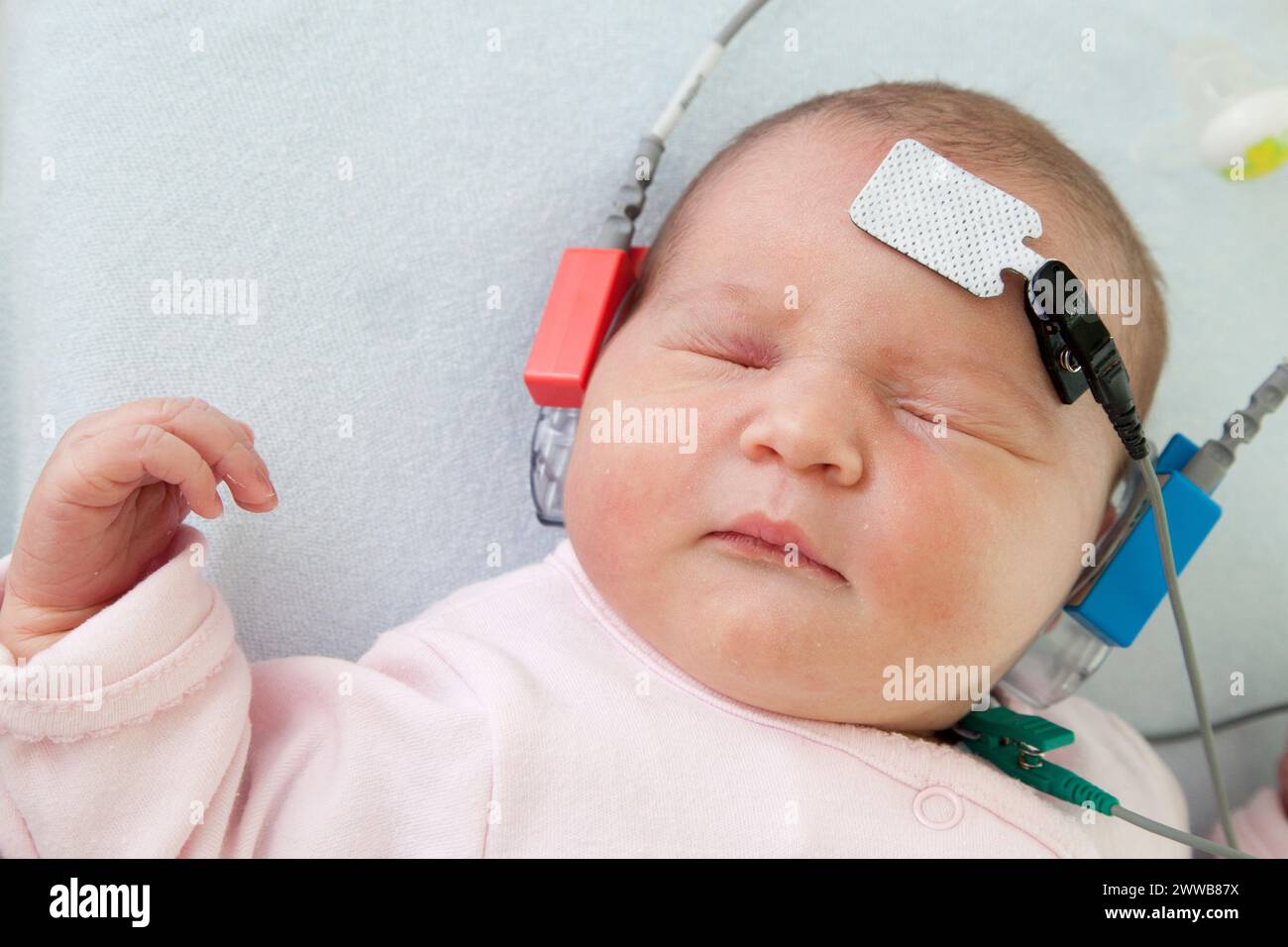 Hearing test - The PEA test (Evoked Hearing Potential) is carried out ...