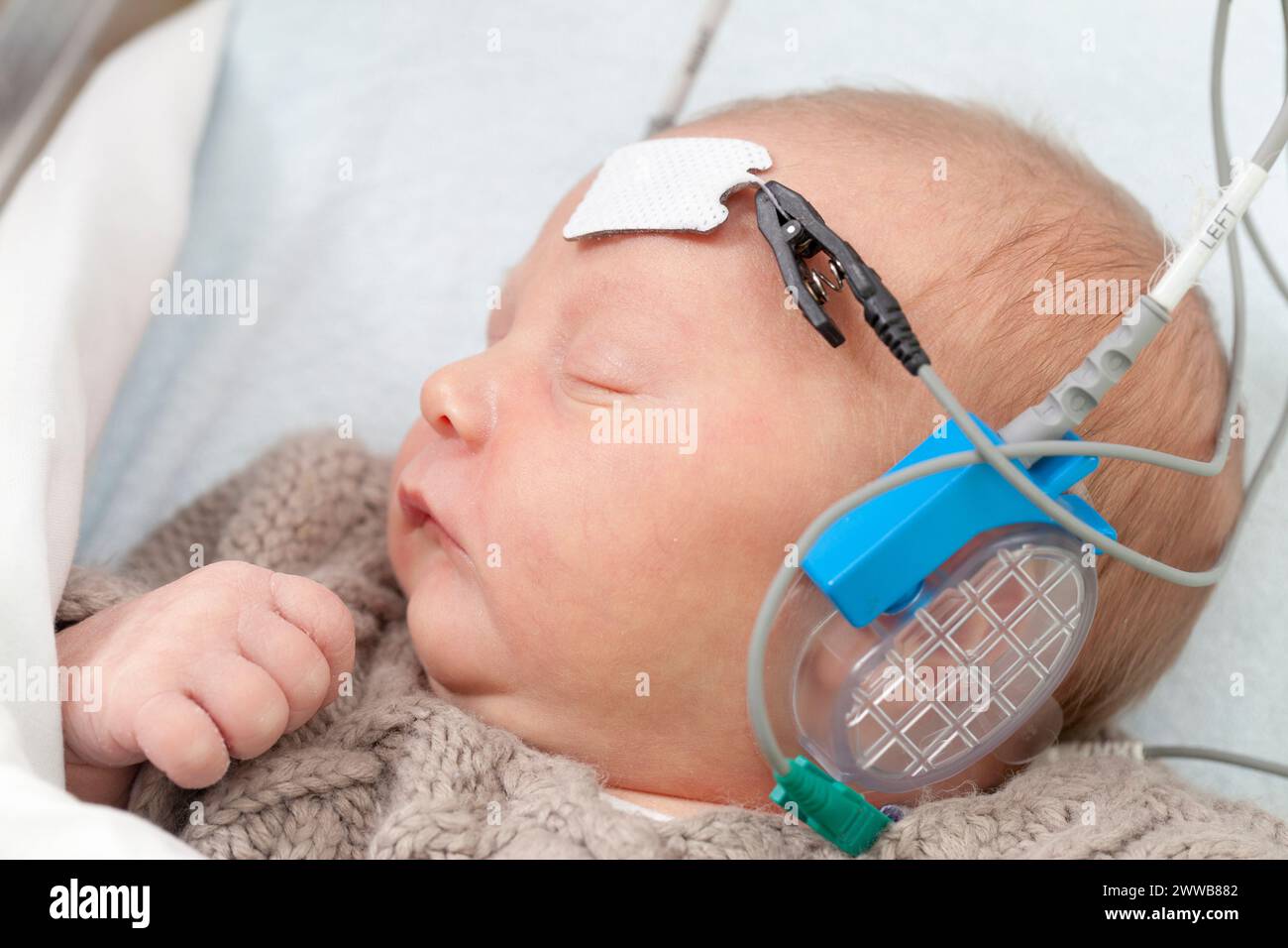 Auditory evoked potentials hi-res stock photography and images - Alamy