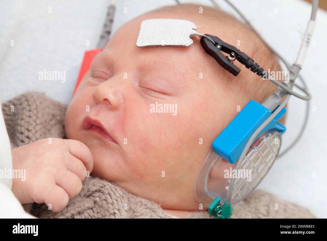 Newborn hearing screening hi-res stock photography and images - Alamy