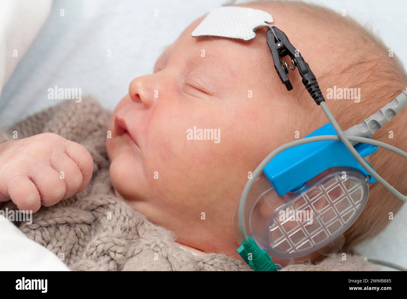 Hearing test - The PEA test (Evoked Hearing Potential) is carried out ...