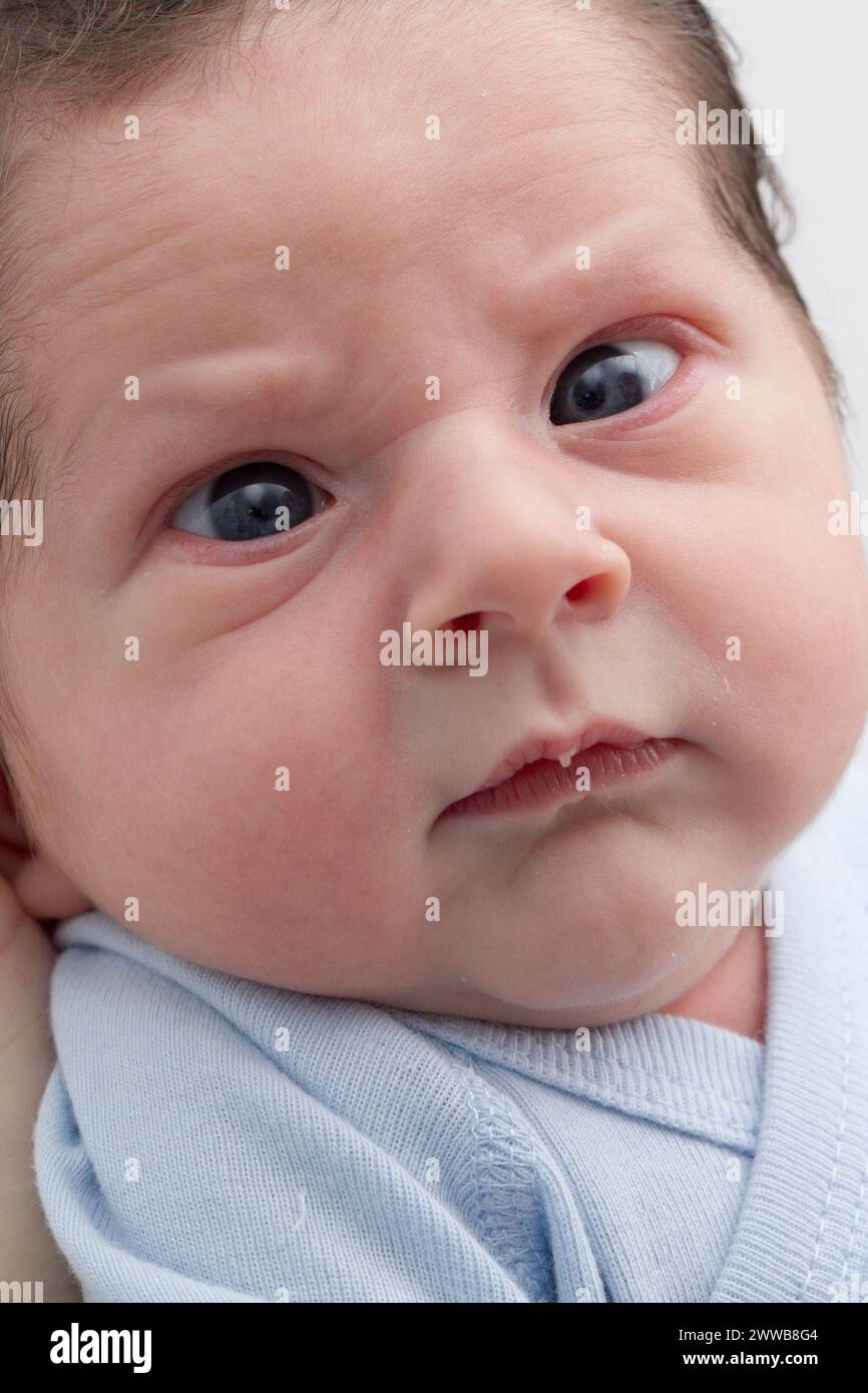 Strabismus baby hi-res stock photography and images - Alamy