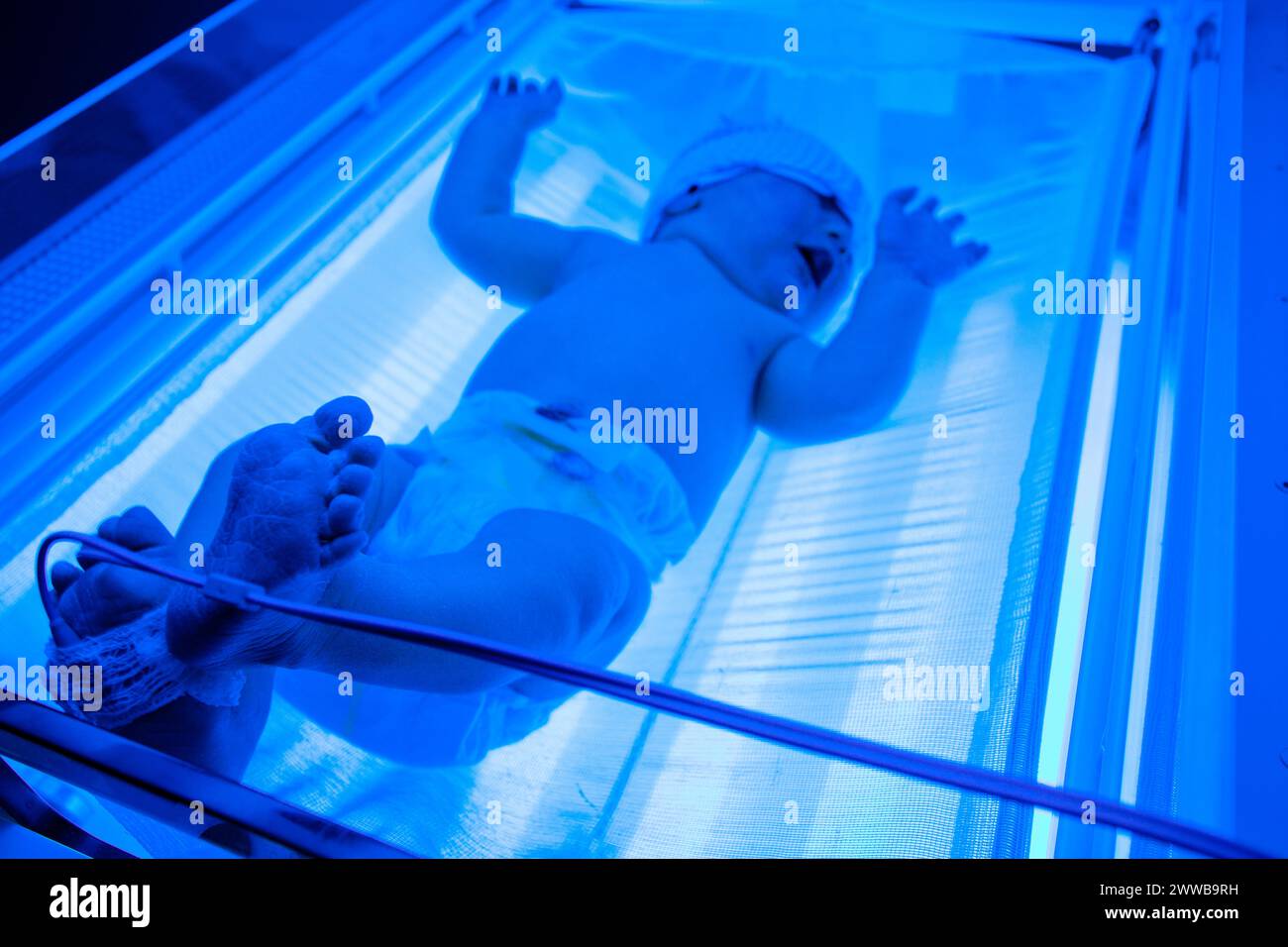 Infants wearing eye masks in phototherapy tunnel. In the first days ...