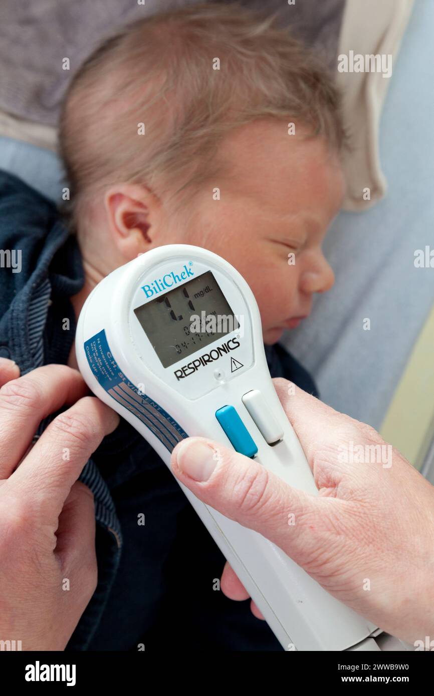Midwife measuring the bilirubin level in a newborn using a ...