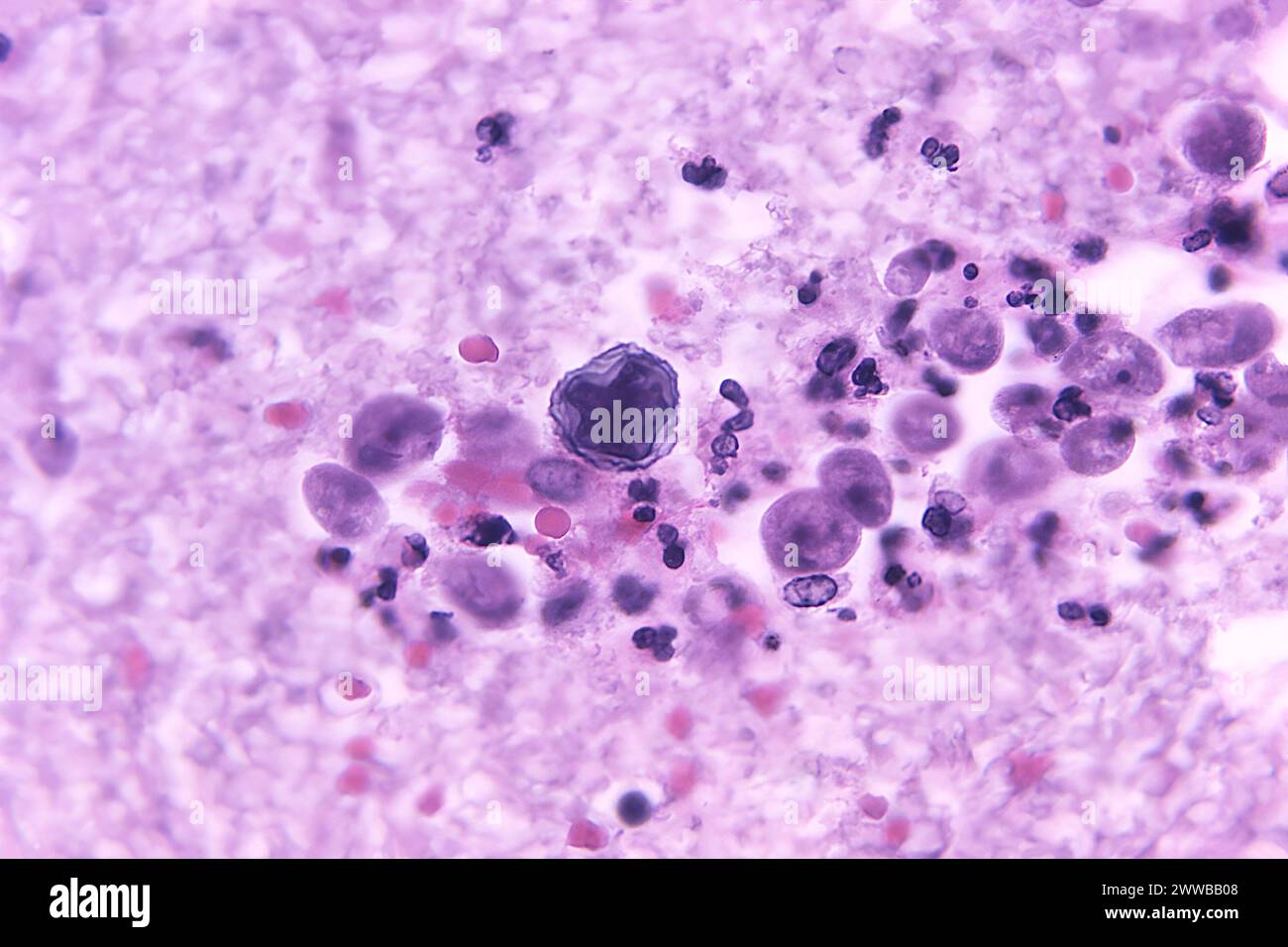 Magnification 500x hi-res stock photography and images - Alamy