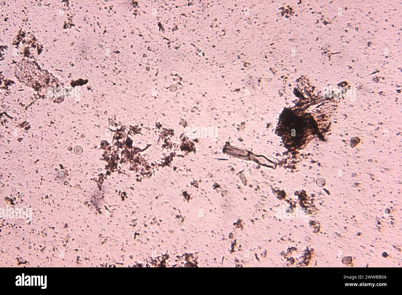 Under 100X magnification Stock Photo - Alamy