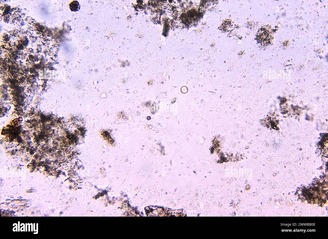 Entamoeba coli cyst hi-res stock photography and images - Alamy