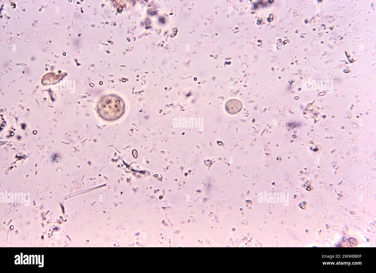 Entamoeba coli hi-res stock photography and images - Alamy