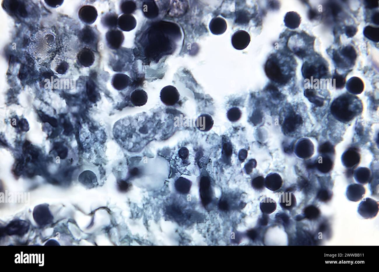 Under 1180X magnification, this 1973 photomicrograph of a hematoxylin ...