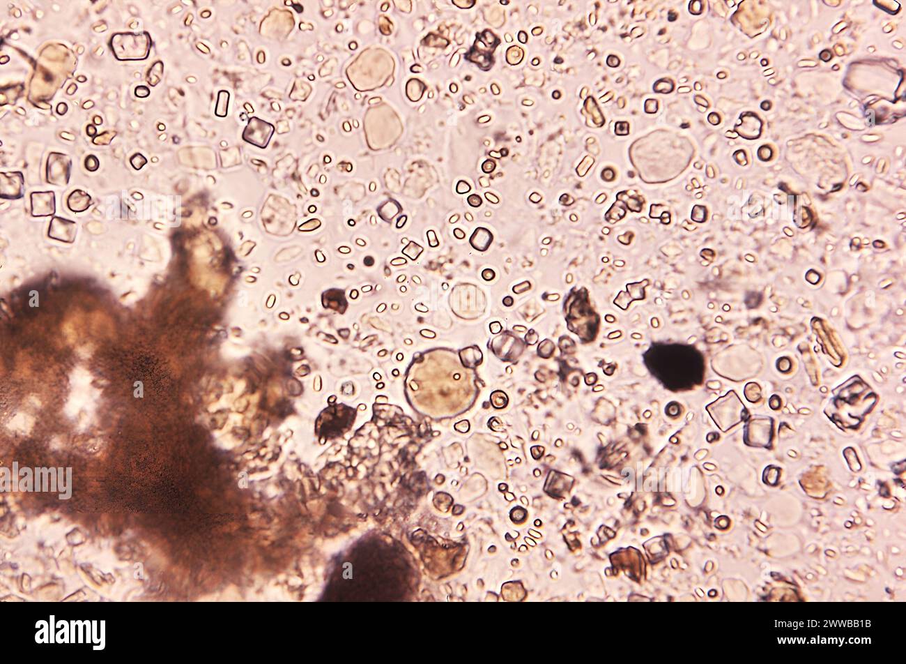 Under 500X magnification, this photomicrograph of a direct mount ...