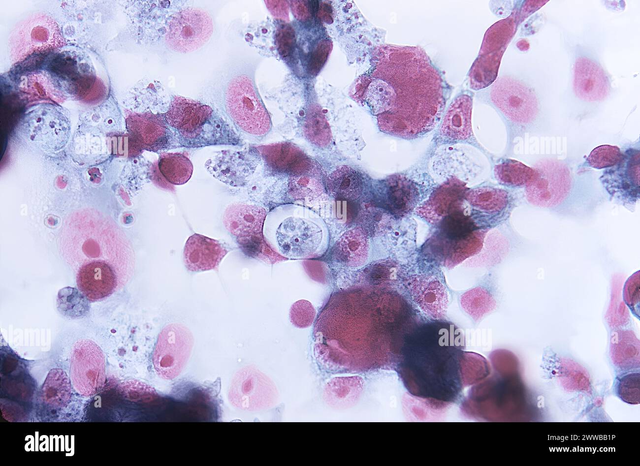 Under 500X magnification, this 1973 photomicrograph of a trichrome ...