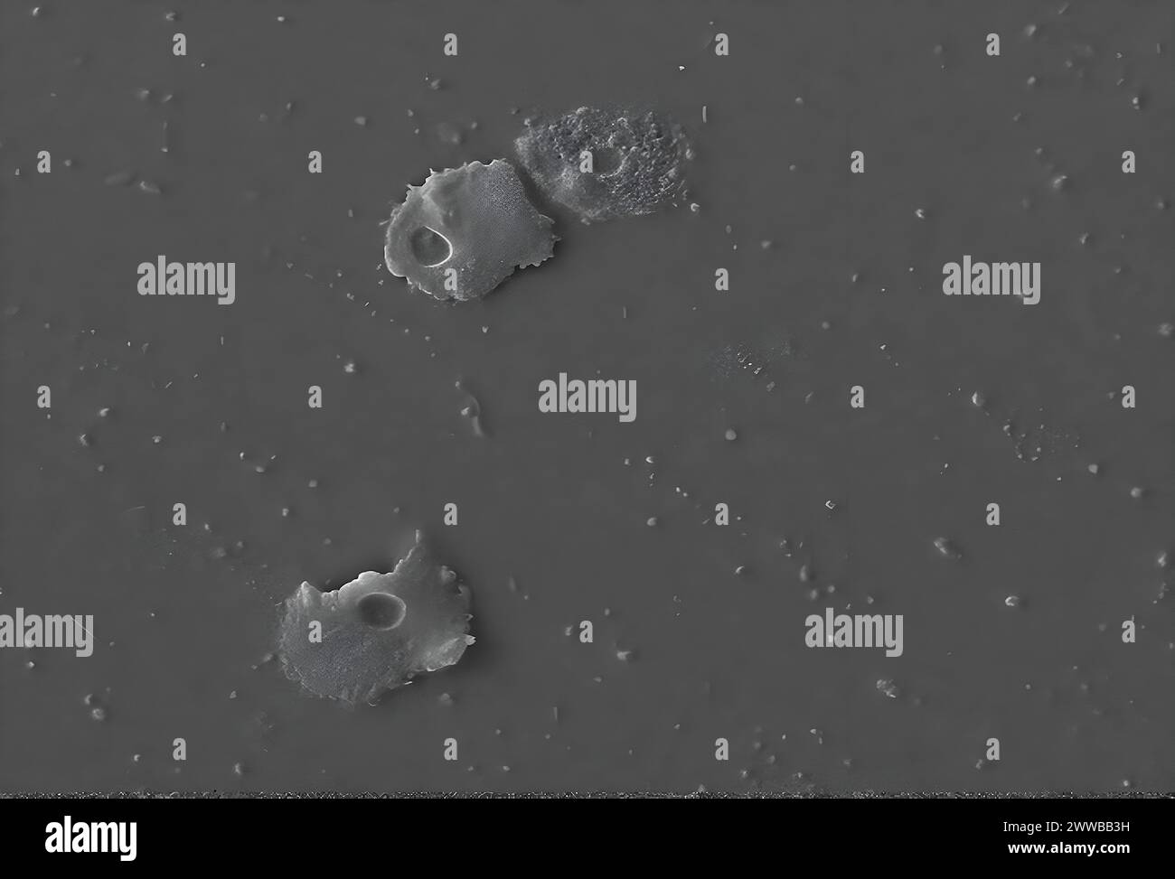 This scanning electron microscope (SEM) image revealed some of the ...