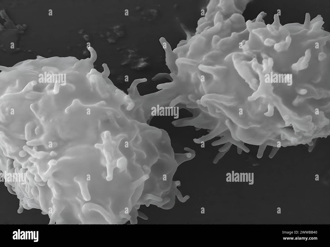 This scanning electron microscope (SEM) image revealed two Acanthamoeba ...