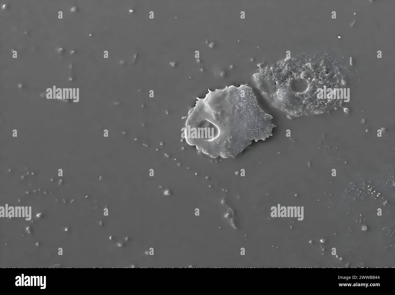 This scanning electron microscope (SEM) image revealed some of the ...