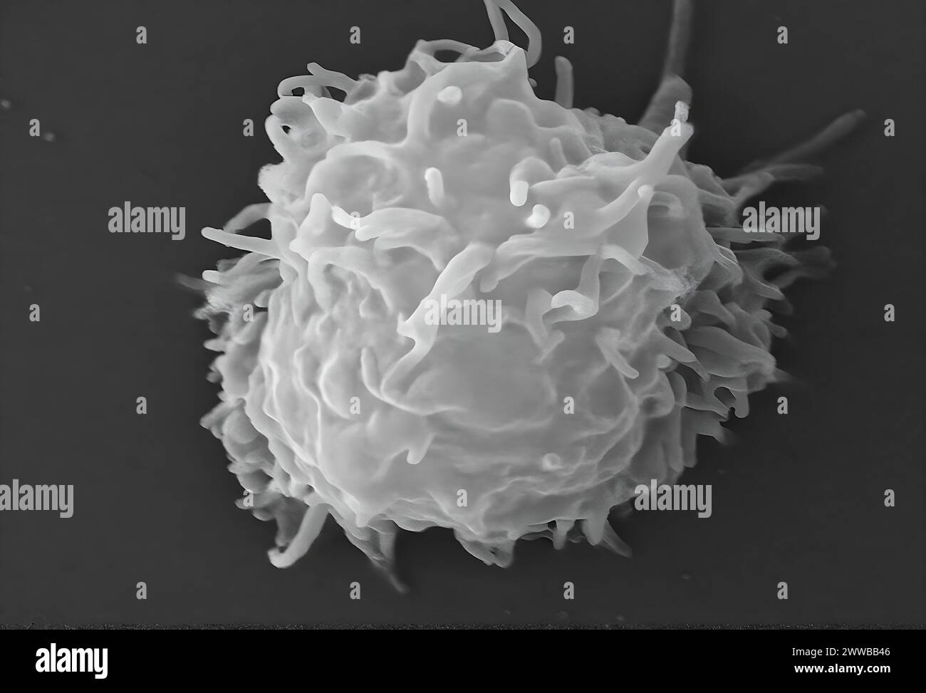 This scanning electron microscope (SEM) image revealed some of the ...