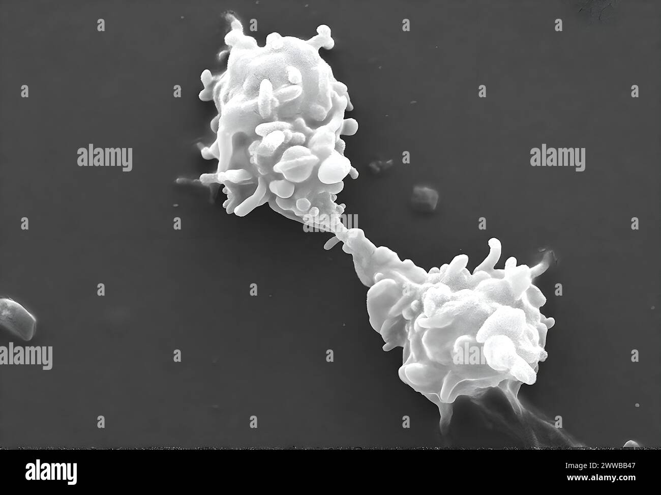 This scanning electron microscope (SEM) image revealed a protozoan ...