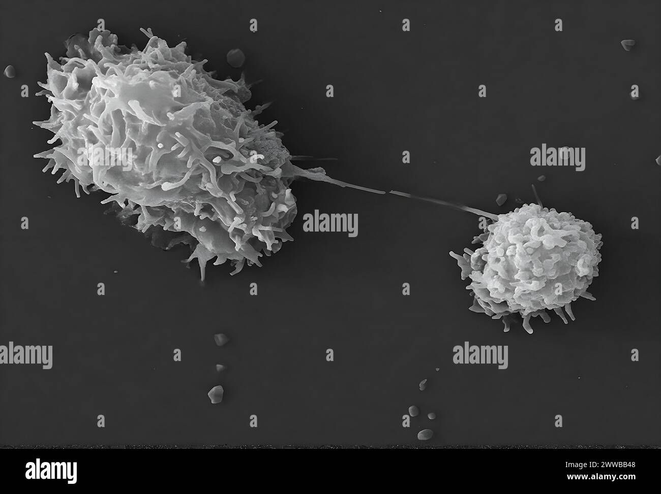 This scanning electron microscope (SEM) image revealed two Acanthamoeba ...