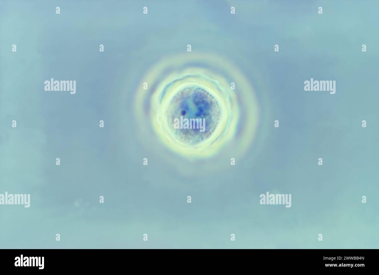 Using phase contrast imaging and magnified 1125X, this photomicrograph ...