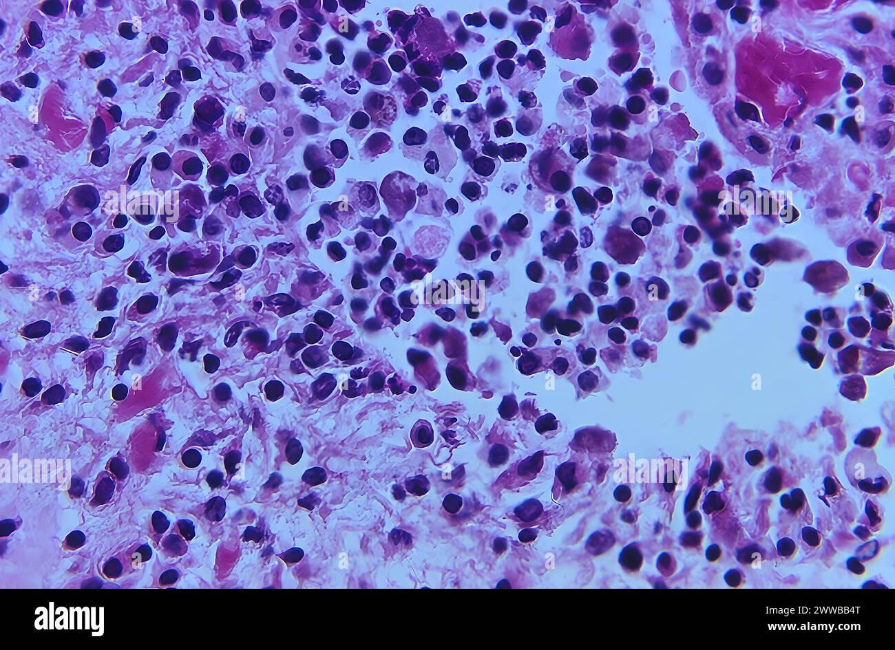 This photomicrograph of a sample of mouse brain tissue revealed the ... This photomicrograph of a sample of mouse brain tissue revealed the ...