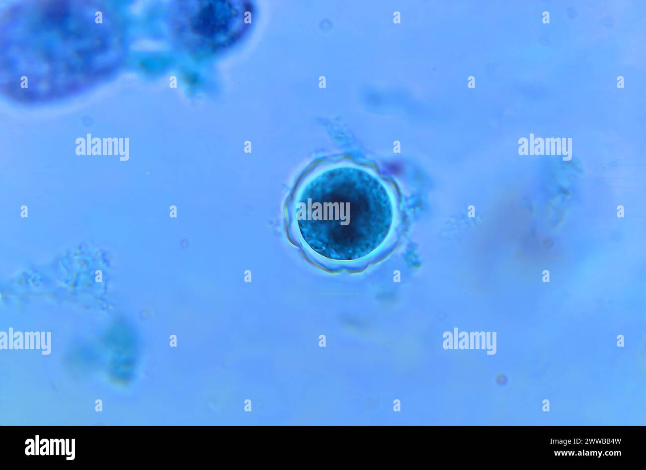 This photomicrograph of a trichrome-stained specimen revealed the ...