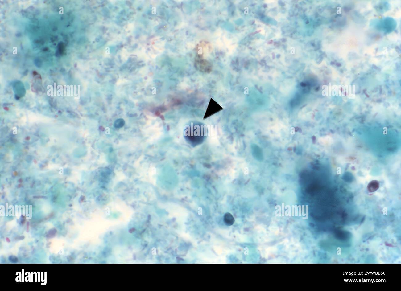 This photomicrograph of a trichrome-stained specimen revealed the ...