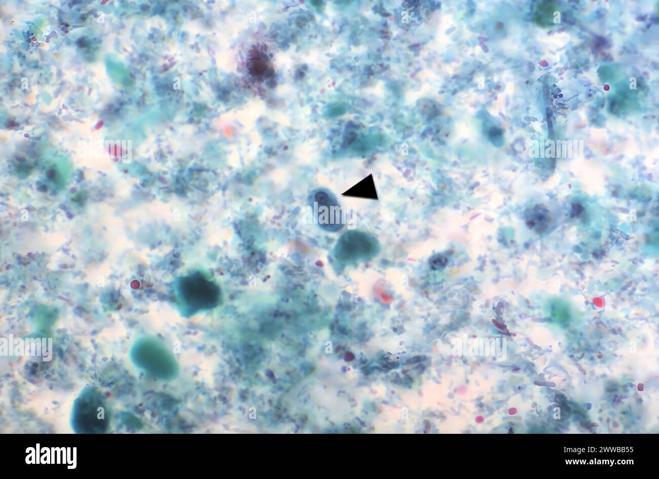 This photomicrograph of a trichrome-stained specimen revealed the ...
