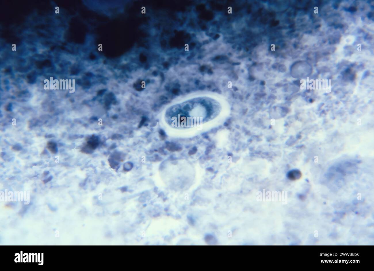 This photomicrograph of a fecal specimen, treated with chlorazol black ...