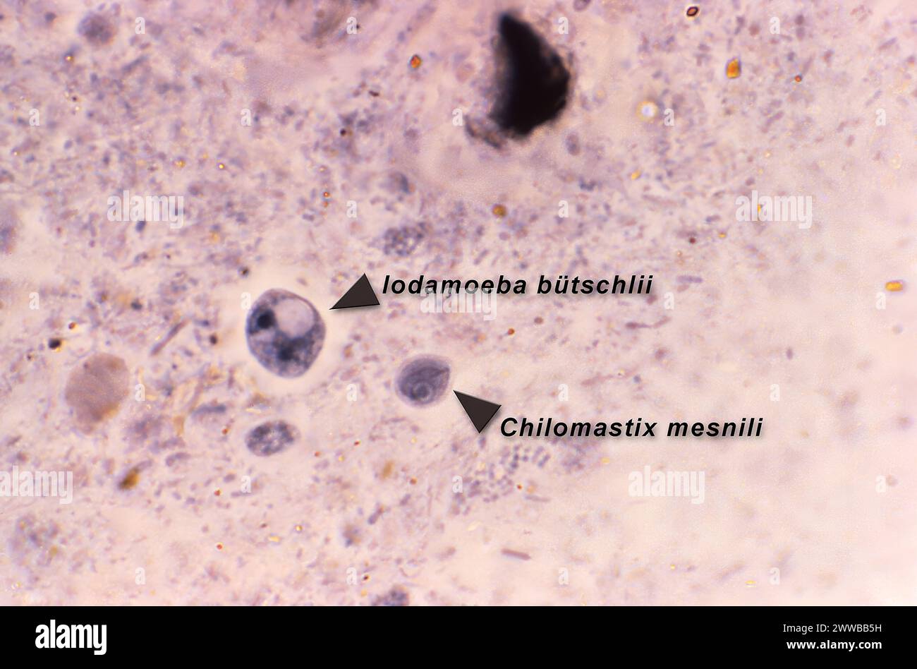 This photomicrograph of an iron-hematoxylin-stained specimen, revealed ...