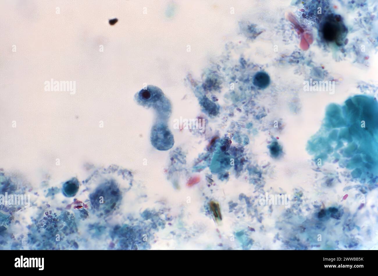 This photomicrograph of a trichrome-stained specimen revealed the ...