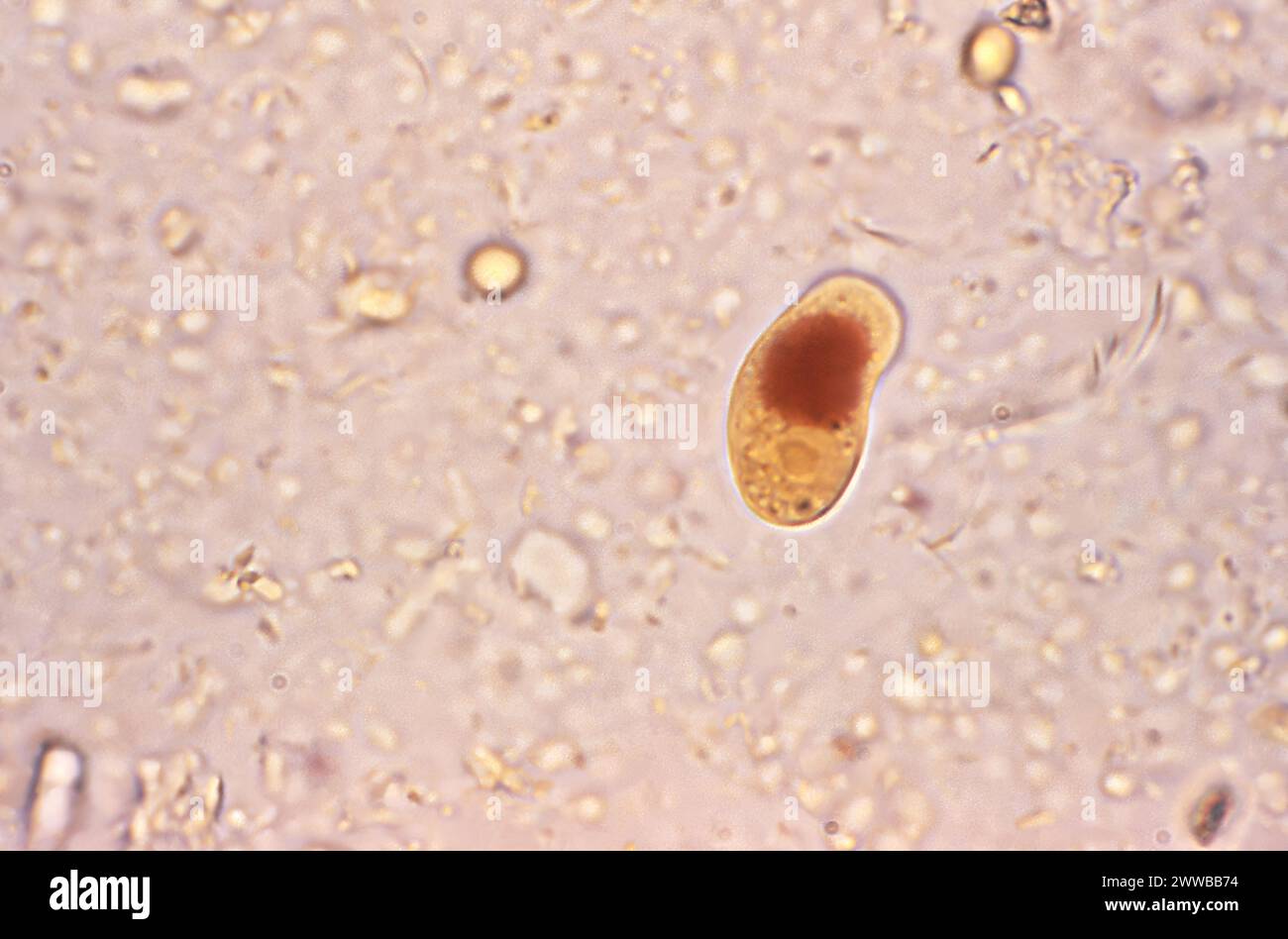 This photomicrograph of an iodine-stained specimen revealed a single ...