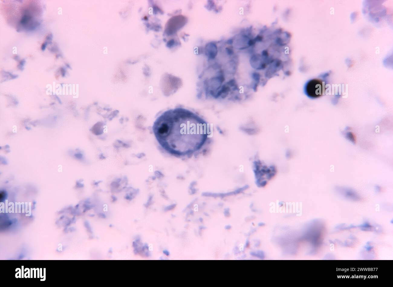 This photomicrograph depicts a single Iodamoeba butschlii (buetschlii ...