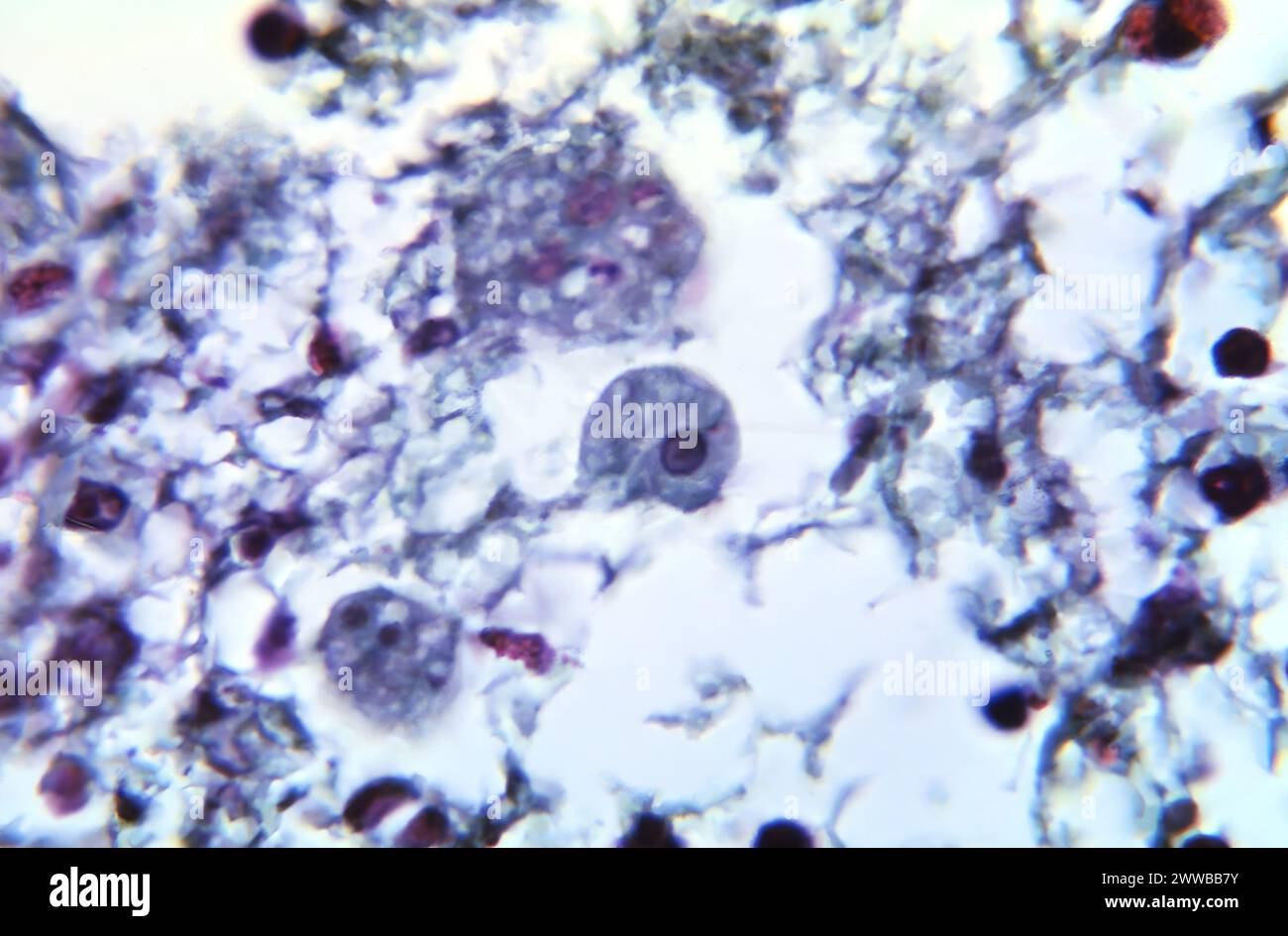 Under 900X magnification, this photomicrograph revealed the presence of ...