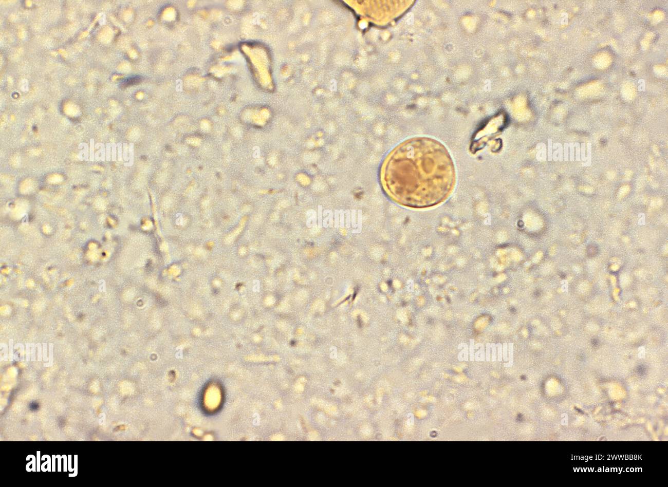 This photomicrograph of an iodine-stained specimen revealed a single ...