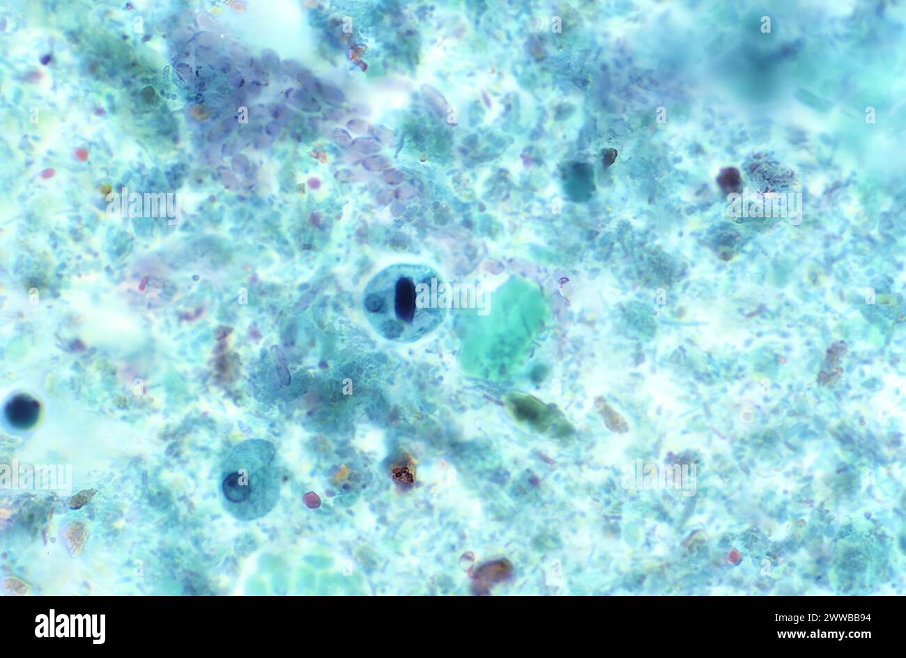 This trichrome-stained photomicrograph revealed some of the ...