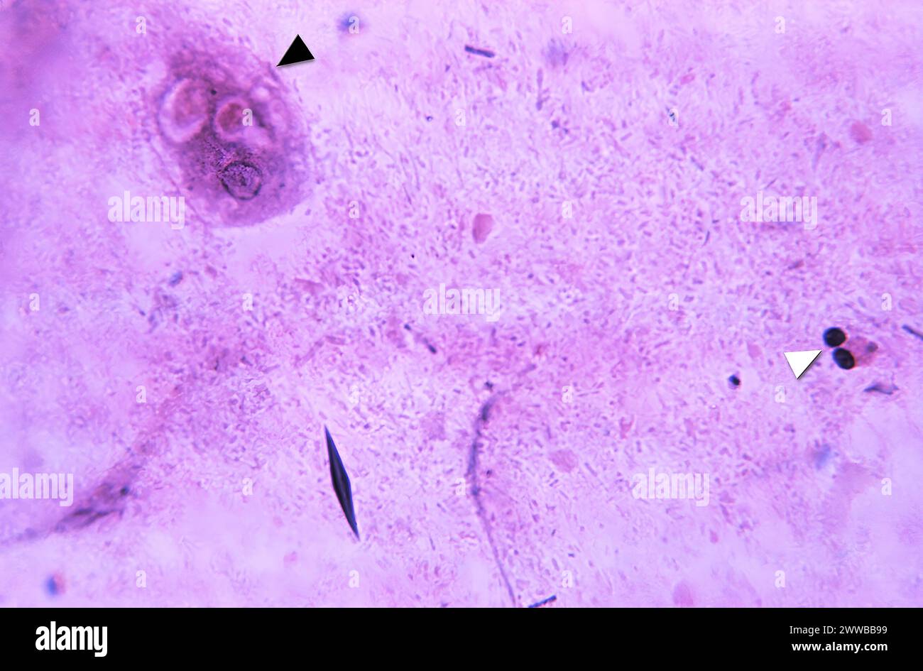 Under 675X magnification, this photomicrograph revealed the presence of ...