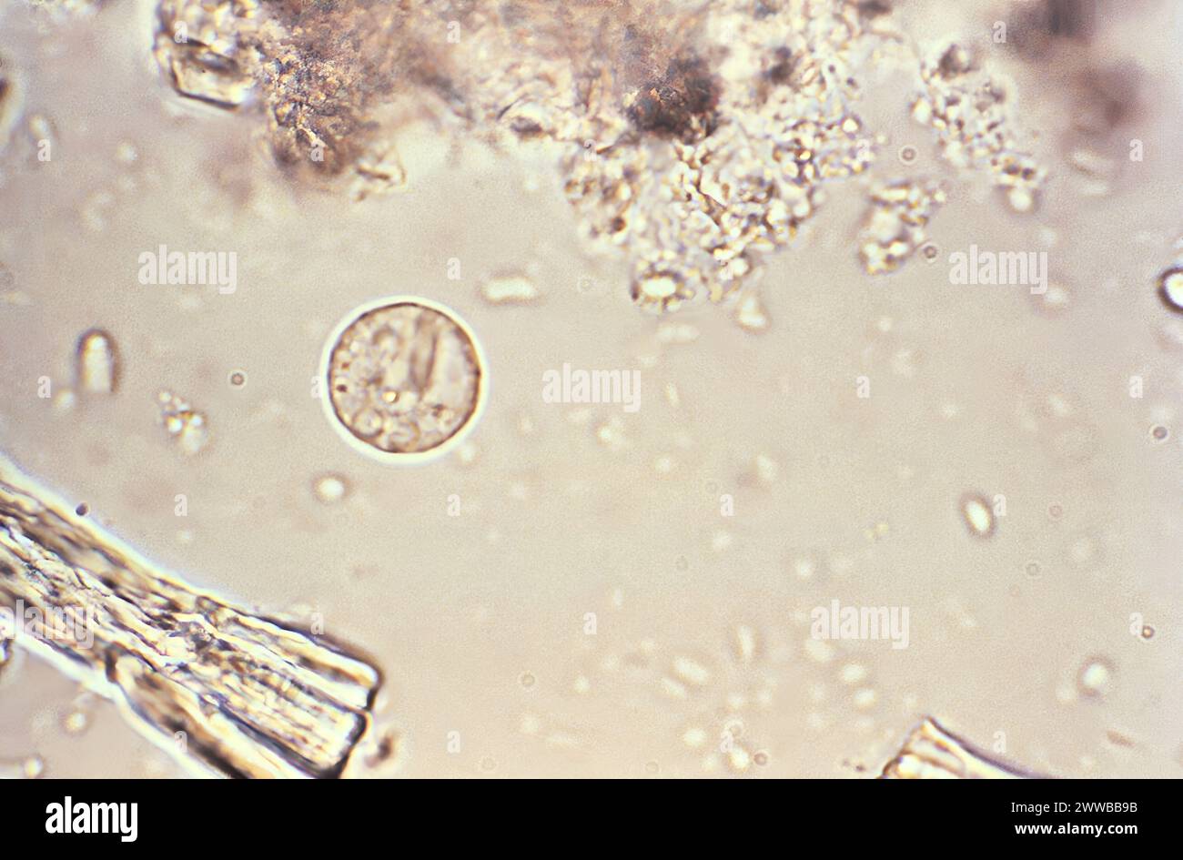 This photomicrograph of an unstained specimen revealed the presence of ...